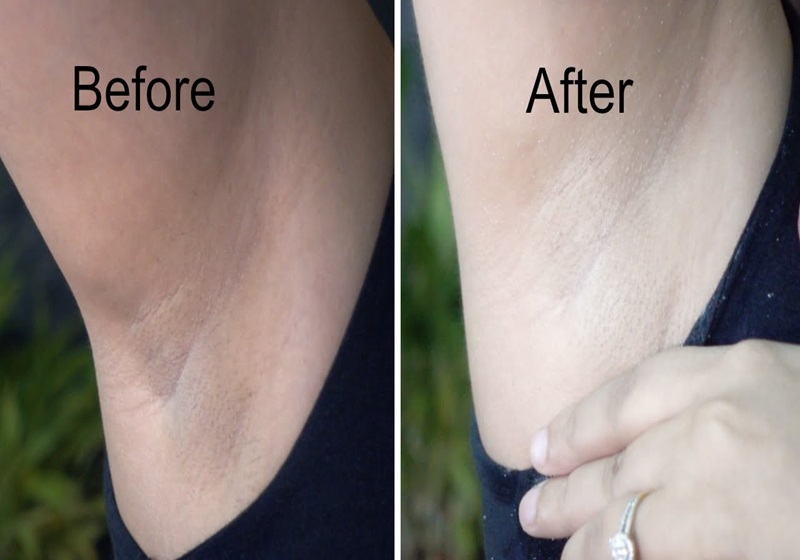 Aura Skin Clinic